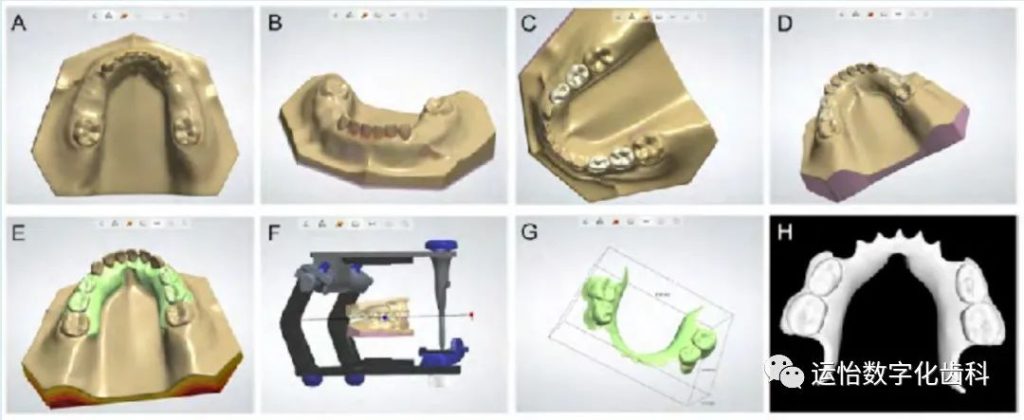 医疗级PEEK材料在椅旁CAD/CAM修复中的应用 | 2023医疗器械展览会牙科论坛关注 - 医疗设备展|医疗器械博览会|医疗器械制造展 ...