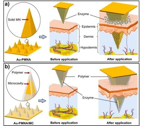 图1 PMNA的设计示意图