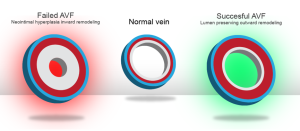 Alucent Biomedical 致力于改善长期临床疗效，并利用天然血管支架（NVS）疗法的血管修复能力解决与传统 PAD 治疗相关的问题。