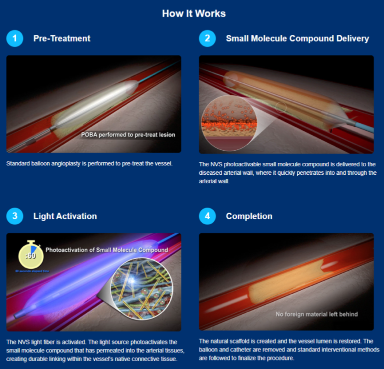 关于Alucent生物医学公司