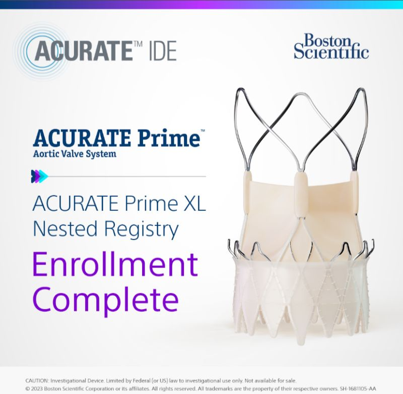 ACURATE Prime XL