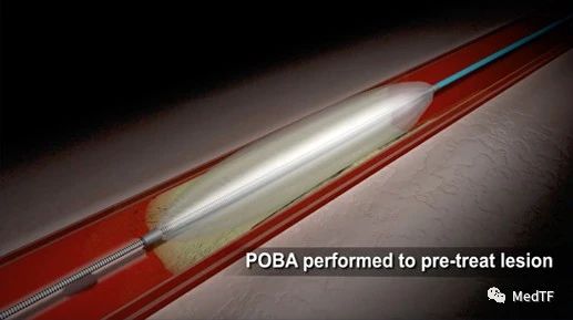 Alucent NVS工作过程