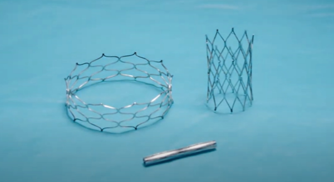 临床医生对Renata Minima Stent评价